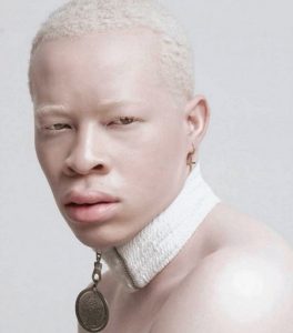 7 Modelos Albinos Mostram Ao Mundo O Quanto São Belos - Admirável Curioso